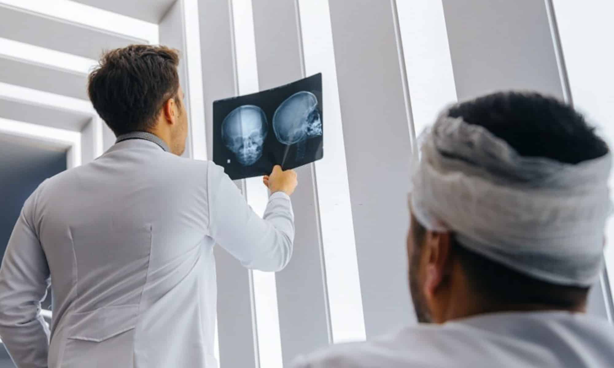 Head Injuries | Car Accident Doctors Group